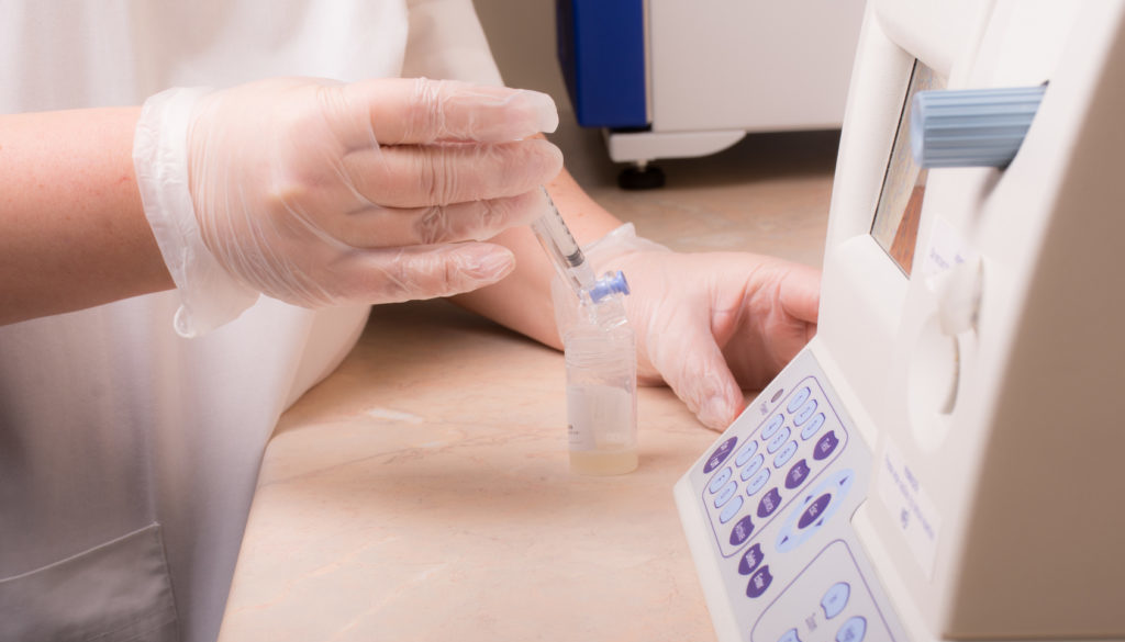 Seminograma: ¿qué es y cómo interpretar sus resultados ...